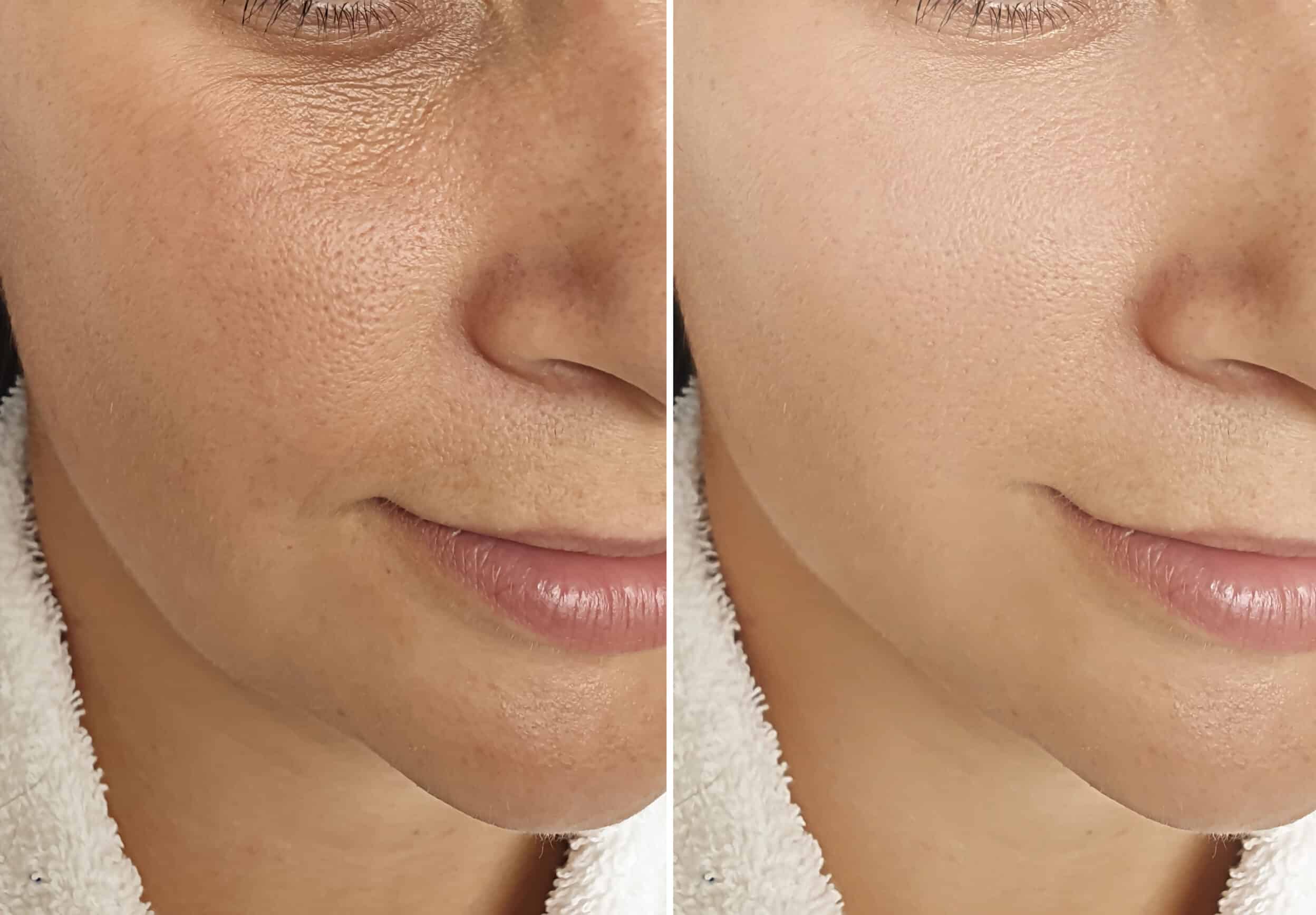 Effortless Photo Retouching: PhotoWorks vs. Mobile Facetune
